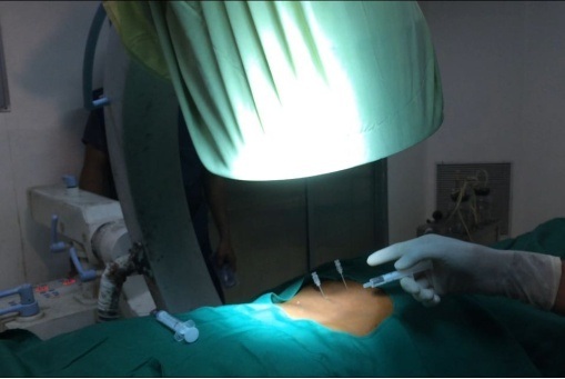 Selective Nerve Root Block - Best spine specialist doctor in Surat - Dr ...